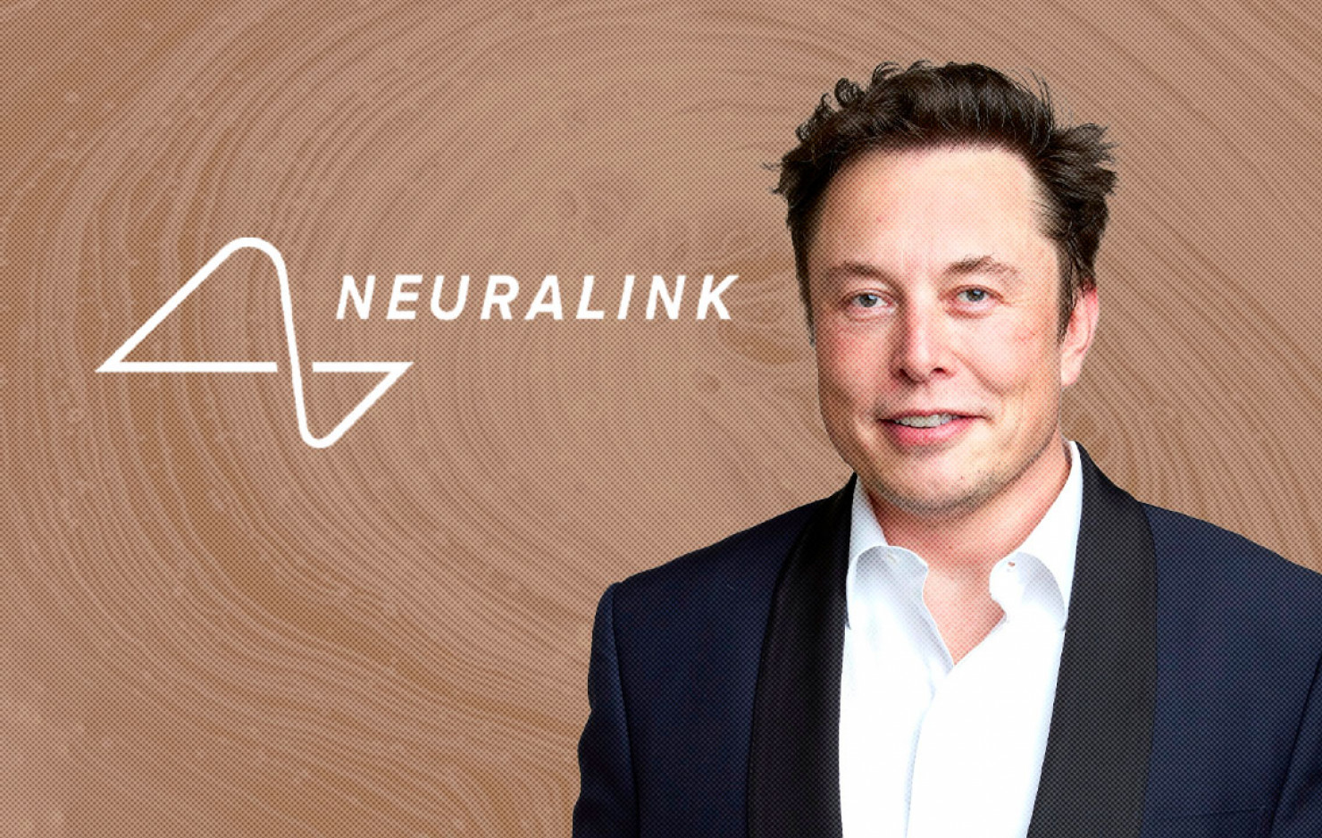 PROYEK AMBISIUS 'PRIME' NEURALINK: PELUANG DAN ANCAMAN IMPLAN CHIP OTAK ...